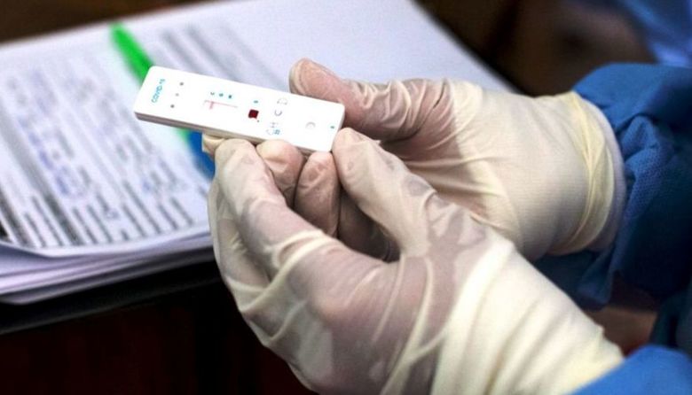 El test serológico rápido creado por científicos de la UNLP ya es ...